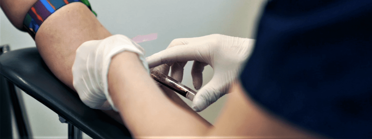 Provtagning – laboratoriet - Primapraktiken